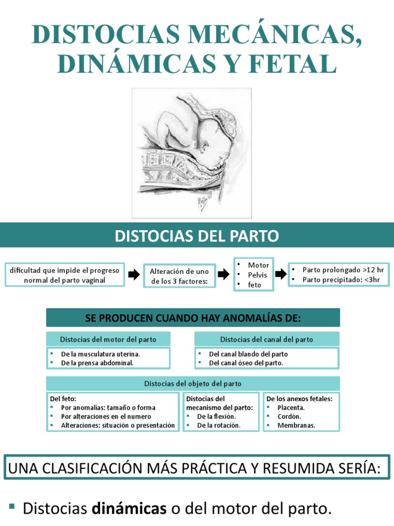 Distocias Mecánicas y Dinamicas | PDF | Parto | Partería