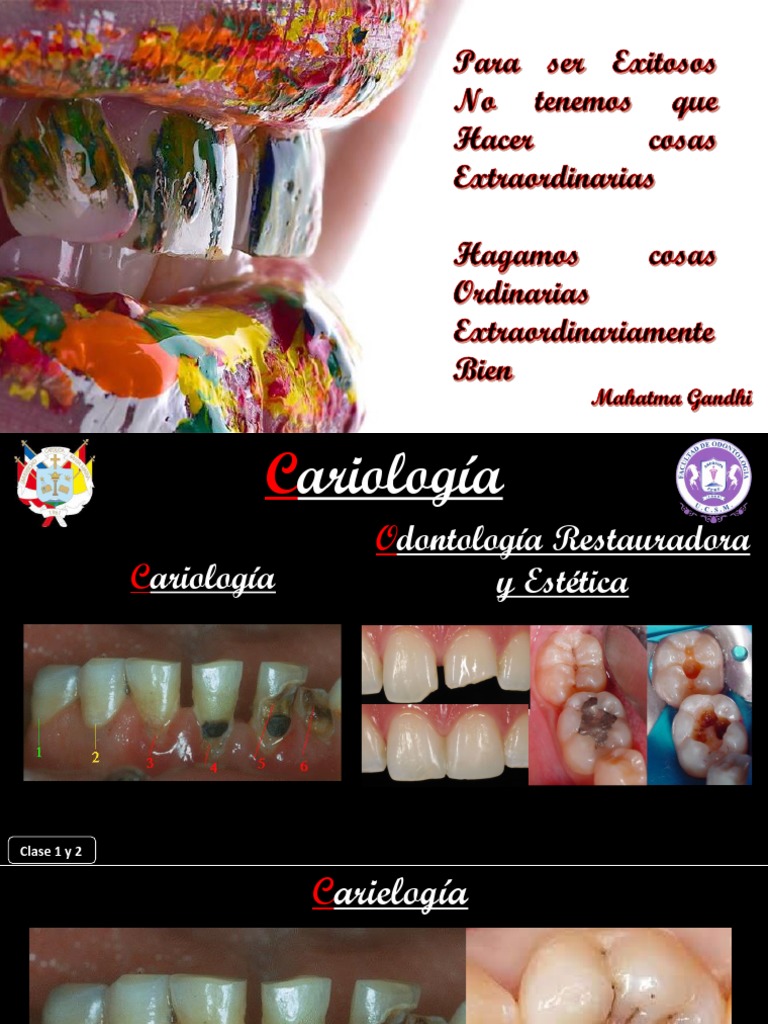 Comprendiendo la Caries Dental y su Tratamiento | PDF