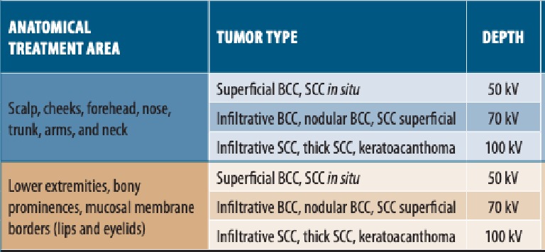 Sensus SRT-100 Energy For Different BCC SCC | PDF