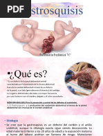 Manejo de Coprostasis en Pediatría | PDF | Recto | Diarrea