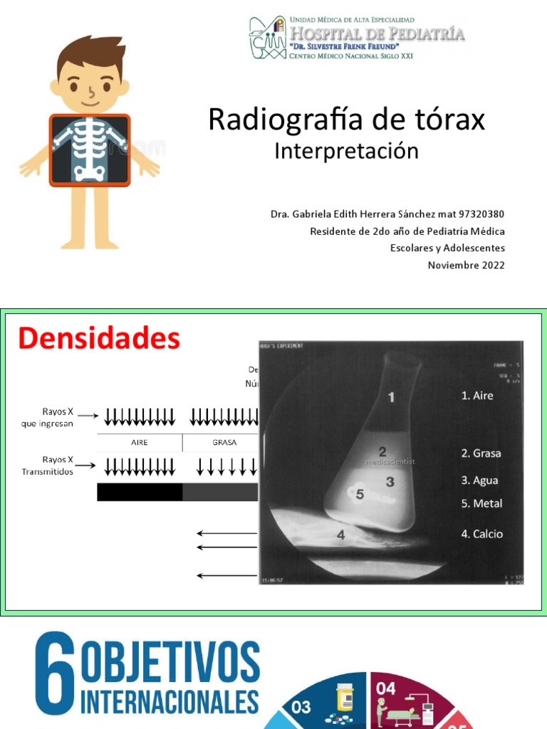 Radiografía de Tórax: Interpretación | PDF | Pulmón | Anatomía