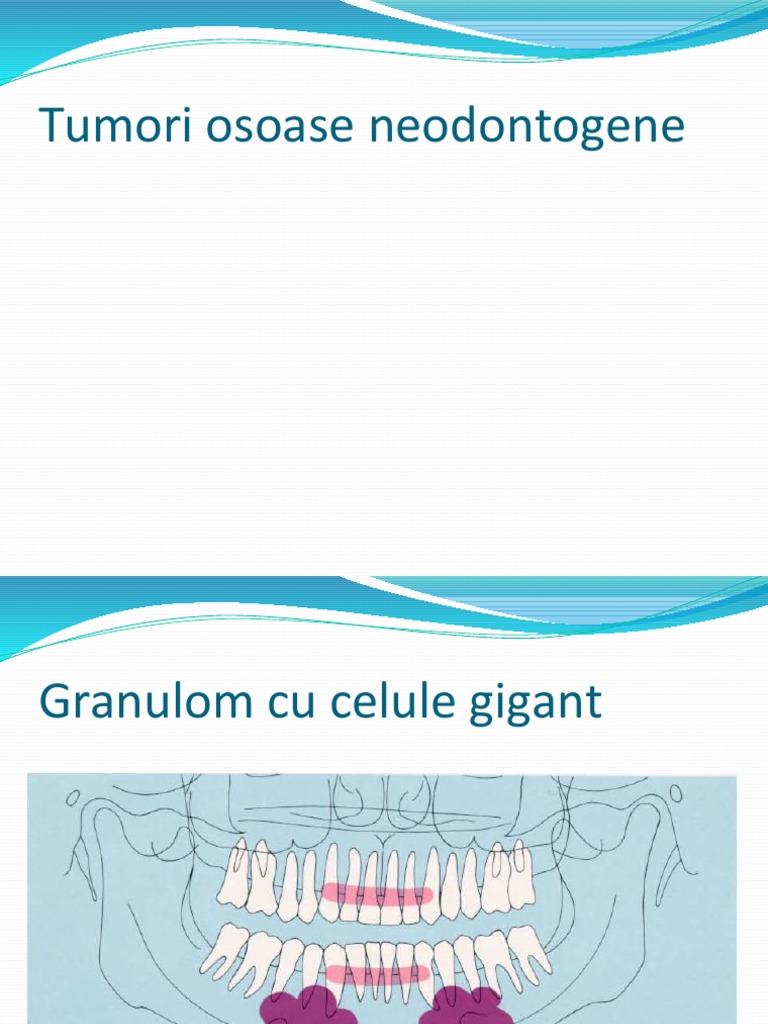 Tumori Osoase Neodontogene | PDF
