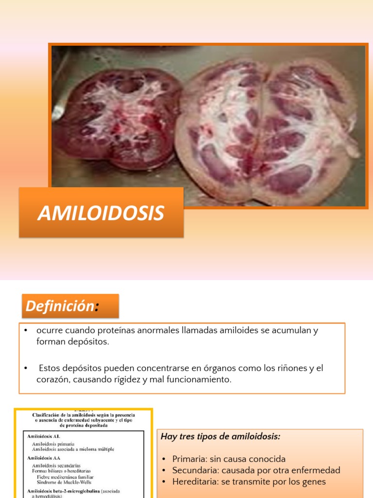 AMILOIDOSIS | PDF | Proteínas | Diagnostico medico