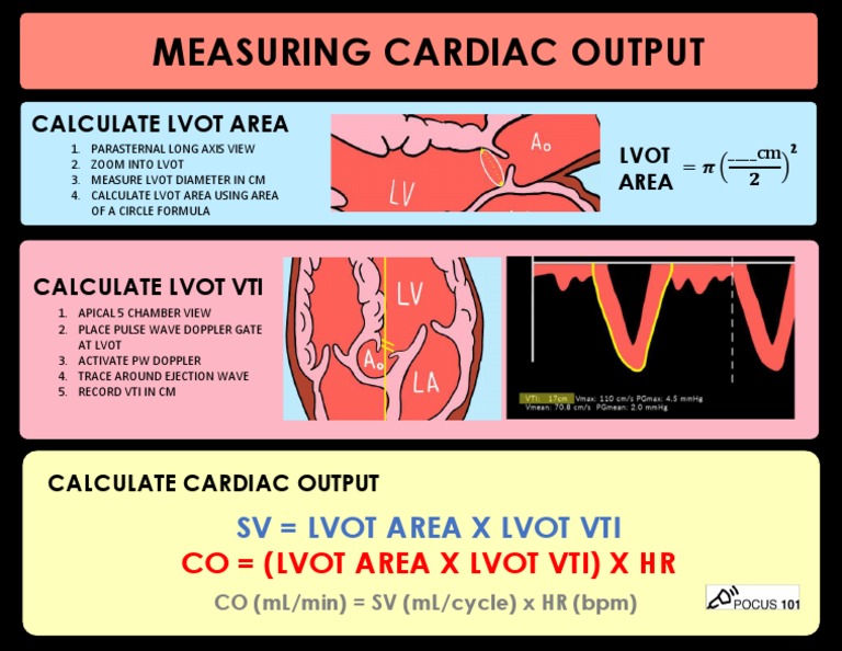 Cardiac Output Stroke Volume Ultrasound Echocardiography Handout PDF ...