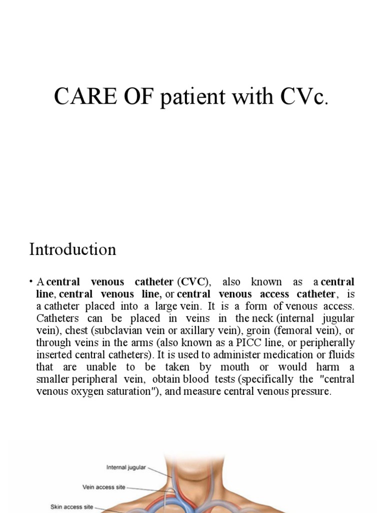 Care of CVP Line | Download Free PDF | Intravenous Therapy | Clinical ...