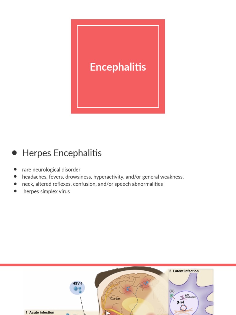 Encephalitis | PDF