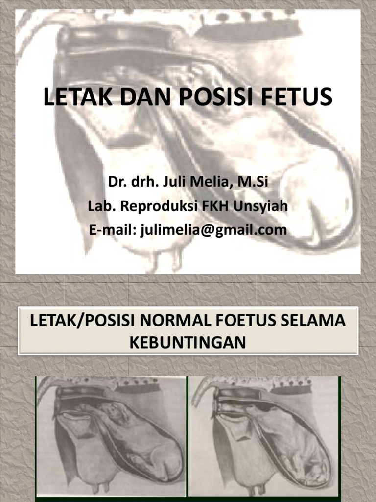 Letak Dan Posisi Fetus | PDF