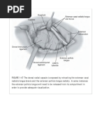 Palmar Approach - Modified Henry Approach | PDF | Hand | Human Anatomy