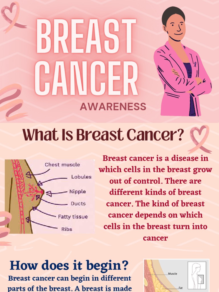 Breast Cancer | PDF | Breast Cancer | Cancer