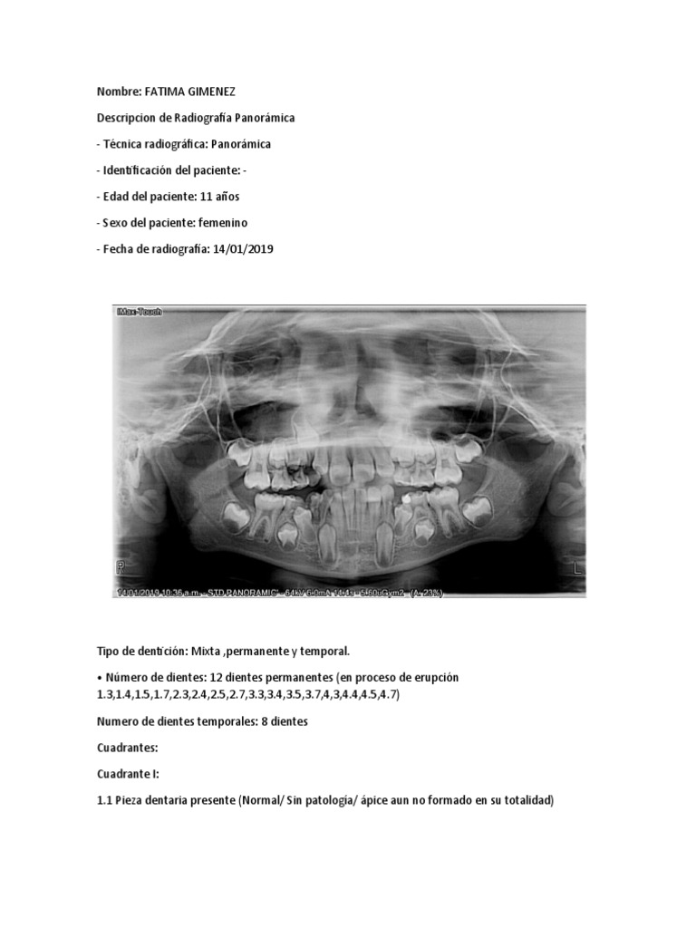 RX Panoramica | PDF | Cabeza y cuello humanos | Anatomía humana