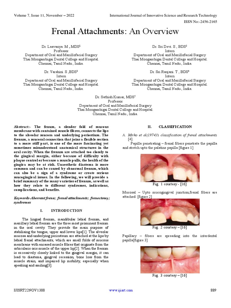 Frenal Attachments An Overview | PDF | Lip | Dentistry Branches