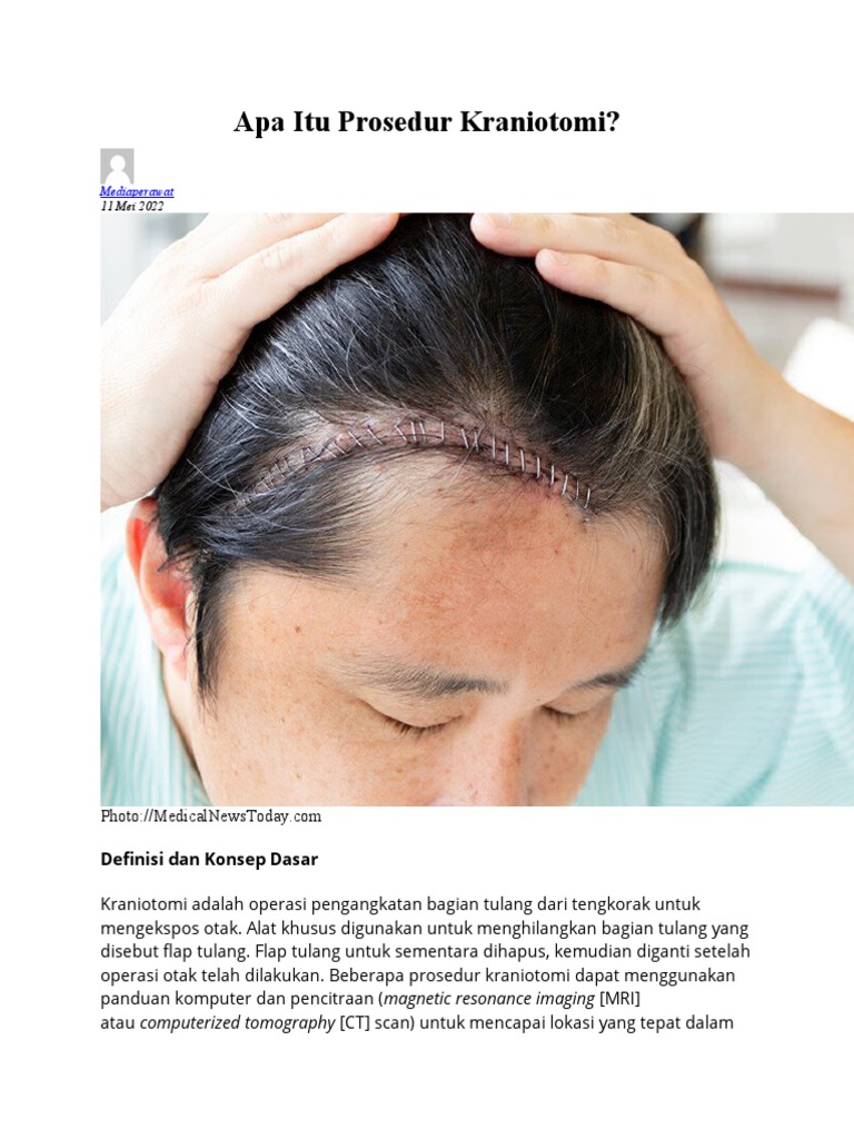 Apa Itu Prosedur Kraniotomi | PDF