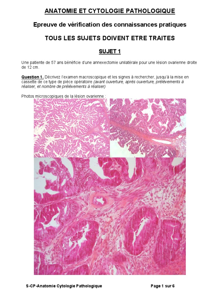 2020 - EVCP PT 1 | PDF | Hépatite B | Médecine clinique