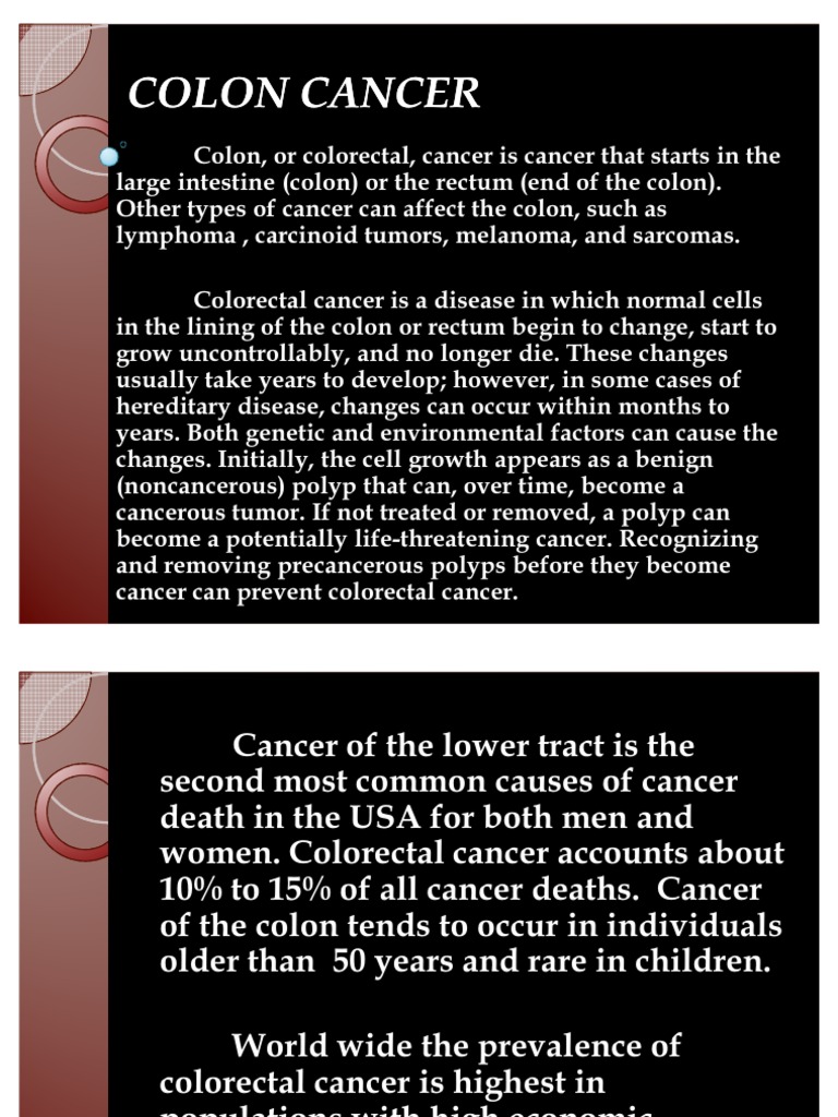 Colon Cancer | PDF