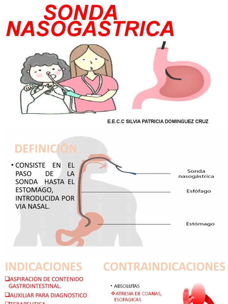 Sonda Nasogastrica Pdf Enfermedades Y Trastornos Gastroenterología