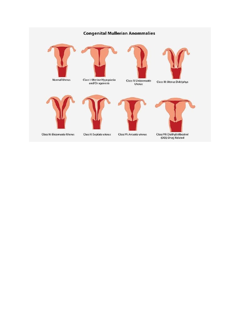 Gambar Jenis Uterus | PDF