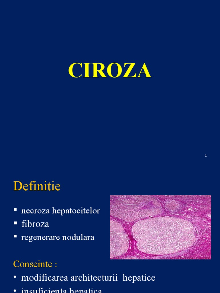 Ciroza Final.2021pptx | PDF