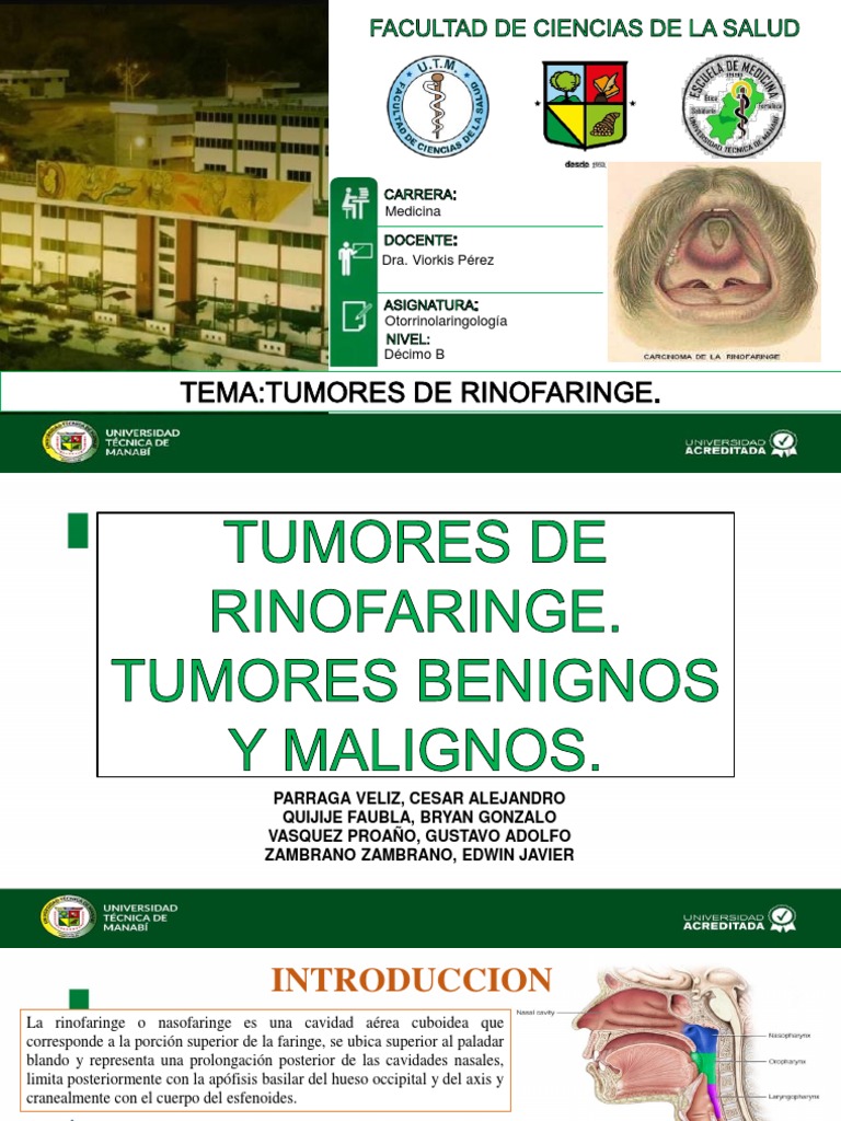 Presentacion Tema 3 Tumores de La Rinofaringe | PDF | Cáncer | Terapia de radiación