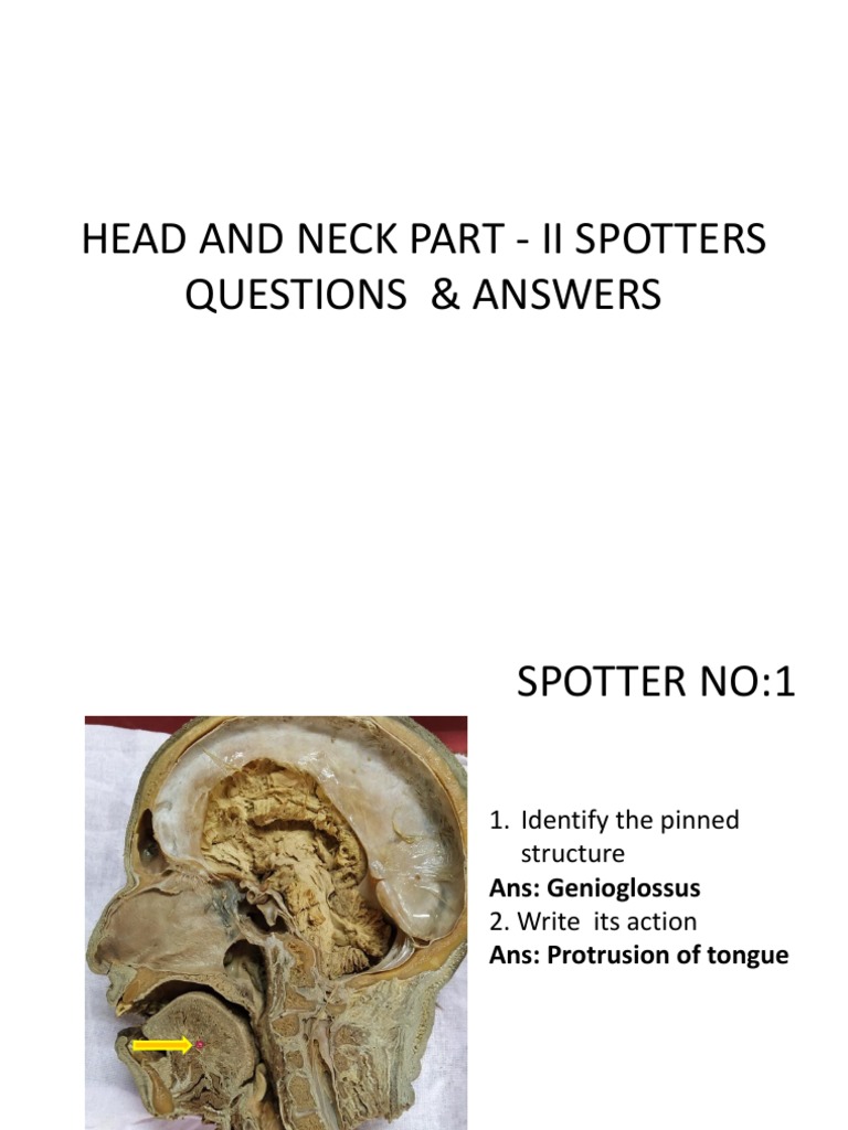 Head and Neck LL Spotters - Q and A | PDF | Epithelium | Human Anatomy
