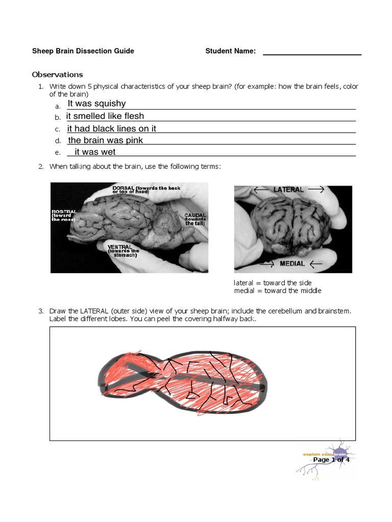 SG Sheep Brain Dissection+ | PDF | Human Brain | Parietal Lobe
