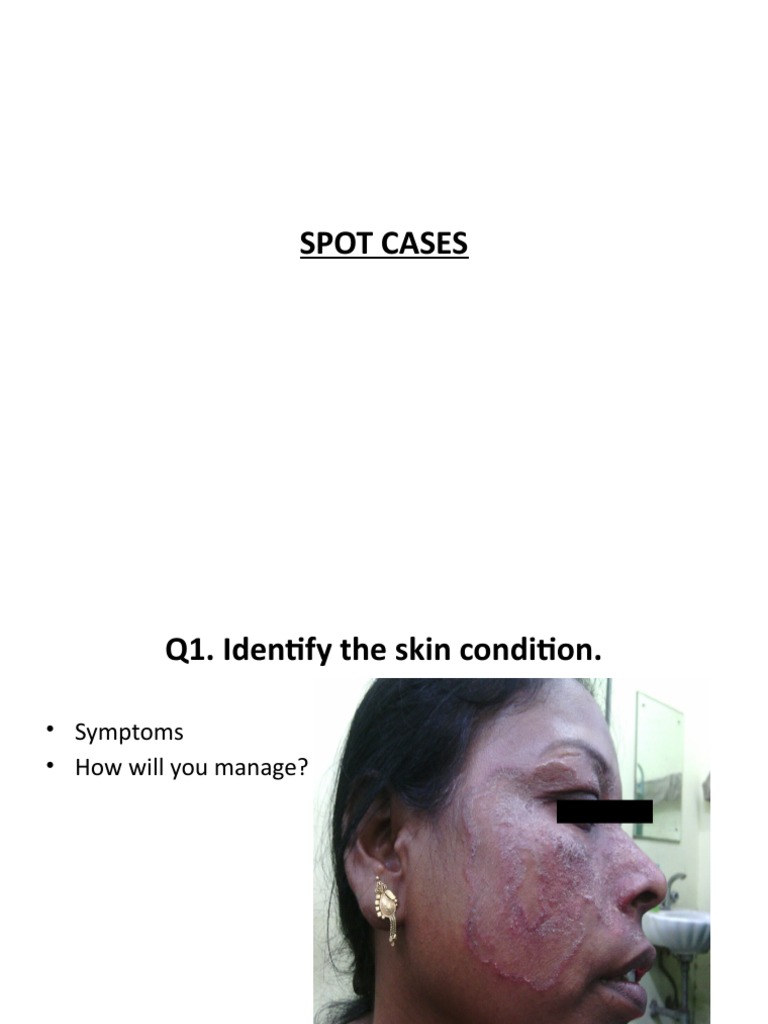 Spot Cases | PDF