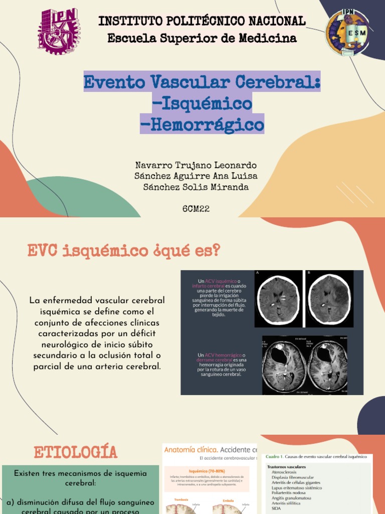 EVC Isquémico y Hemorrágico. | PDF