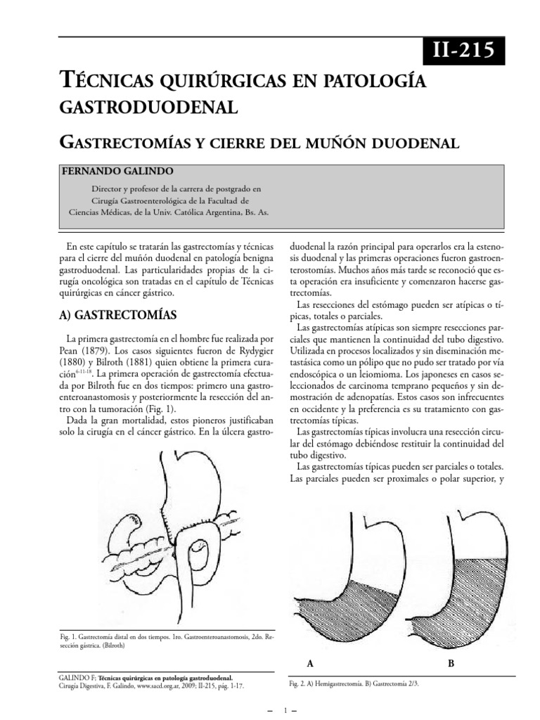 Técnicas de Gastroyeyunal en Cirugía | PDF | Estómago | Úlcera péptica