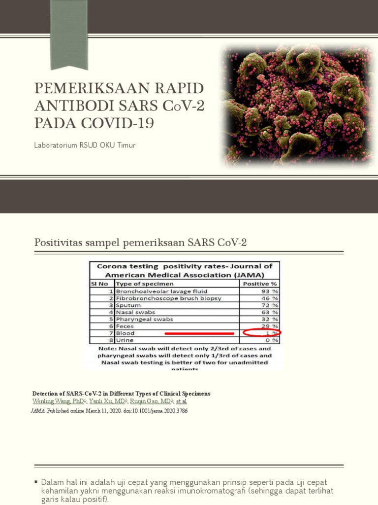 Pemeriksaan Rapid Test Antibodi Pada Covid-19 | PDF | Kesehatan Holistik