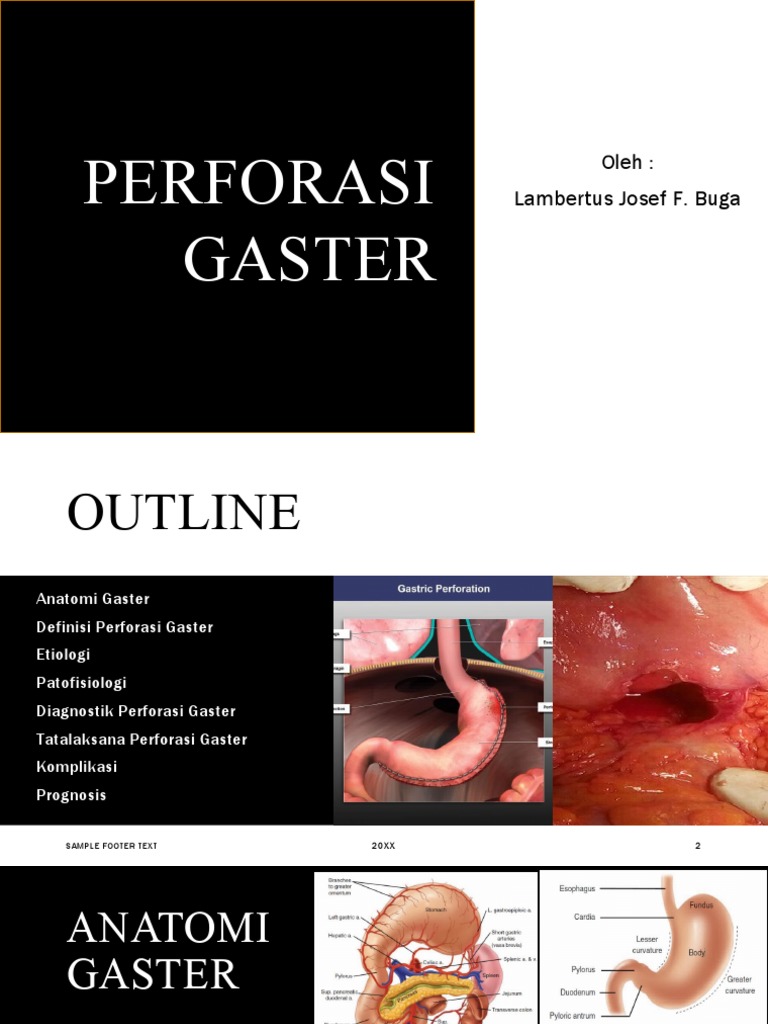 Perforasi Gaster - JFB | PDF