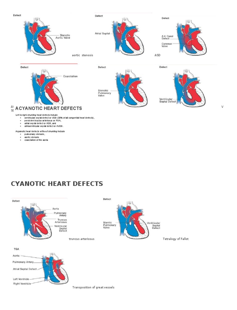 Heart Defects