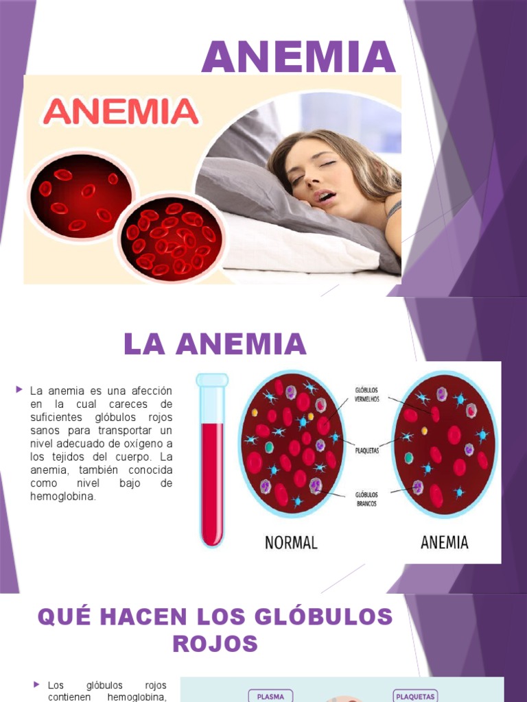 ANEMIA | PDF | Anemia | Glóbulo rojo