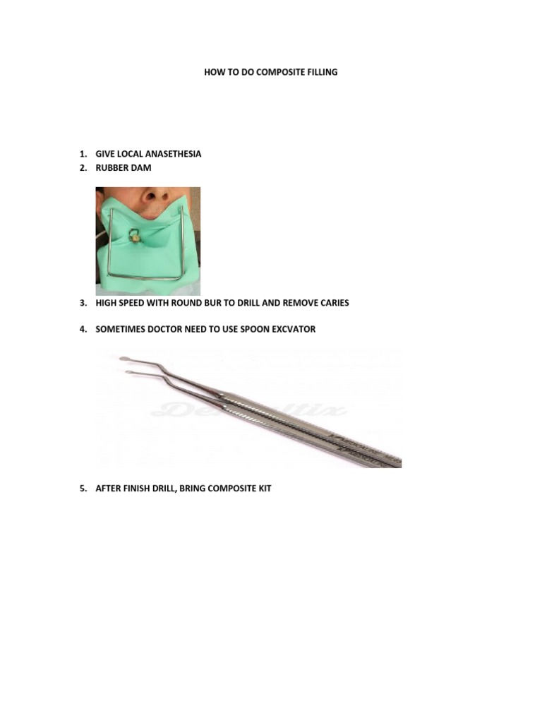 Dental Composite Filling Guide | PDF