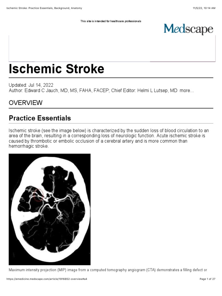 Ischemic Stroke: Practice Essentials, Background, Anatomy | PDF ...