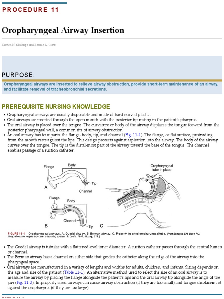 Oropharyngeal Airway Insertion Guide | PDF