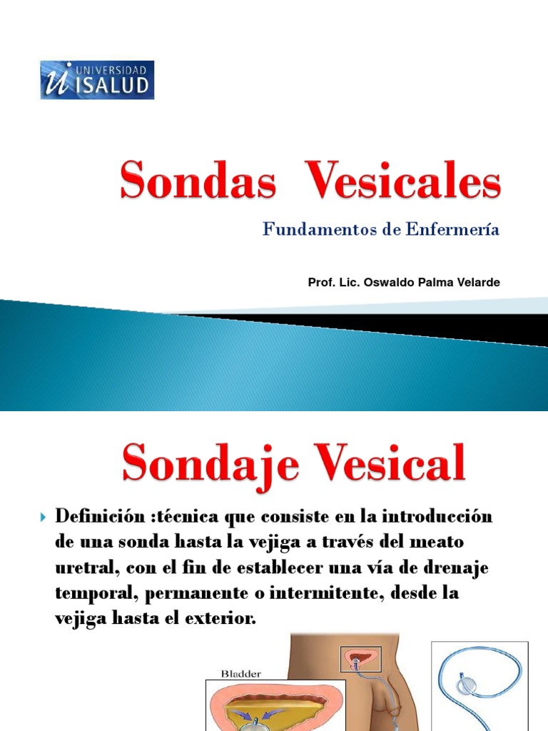 Sondas Vesicales Y Sonda Nasogástrica Pdf Especialidades Medicas