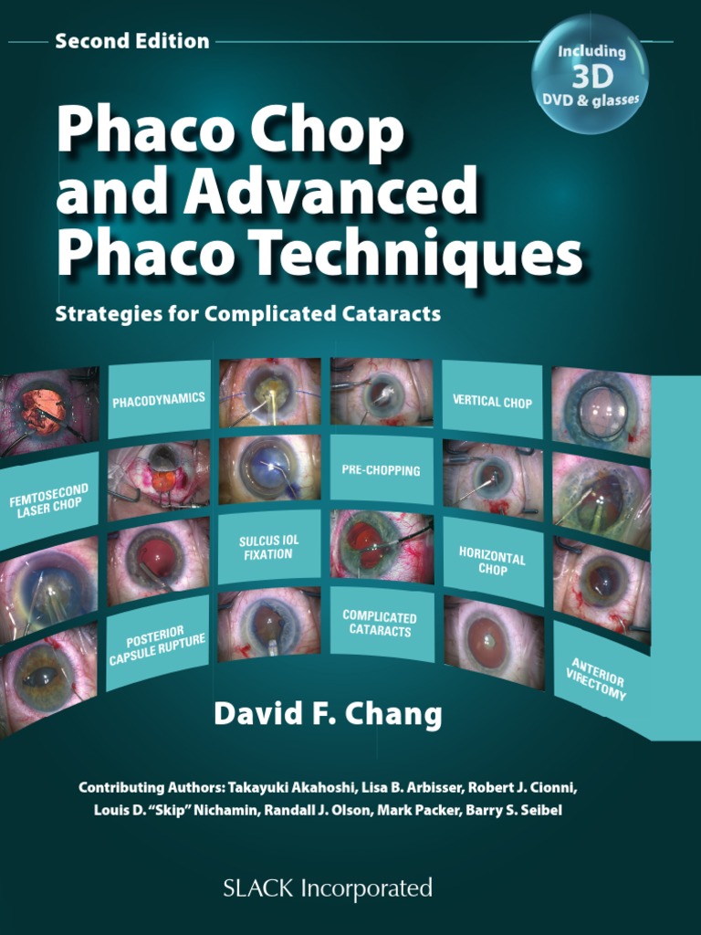 Phaco Chop and Advanced Phaco Techniques Strategies for Complicated ...