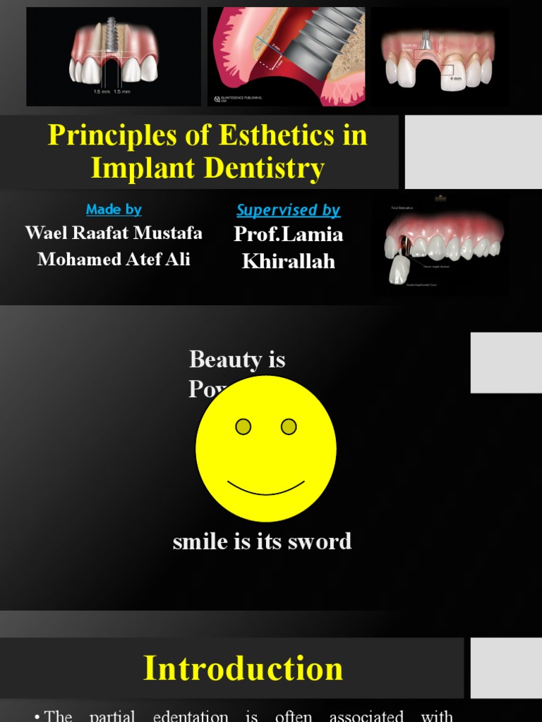 Principles of Achieving Successful Esthetics in Implant Dentistry | PDF ...