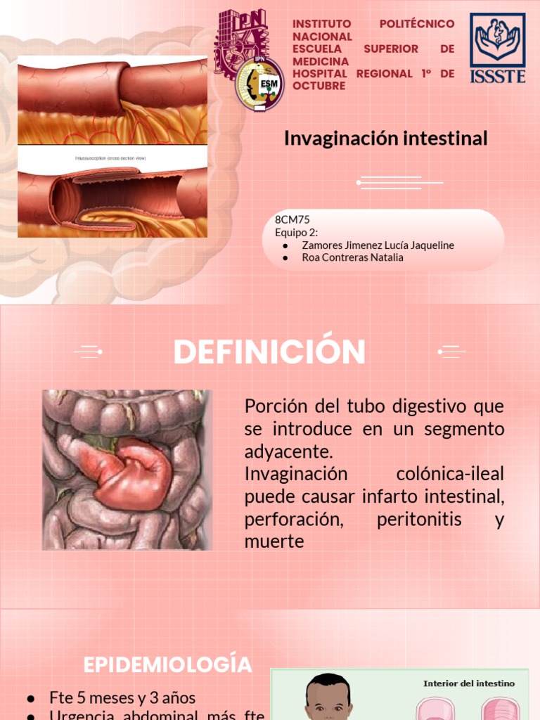 Invaginación Intestinal | PDF | Tracto gastrointestinal | Gastroenterología