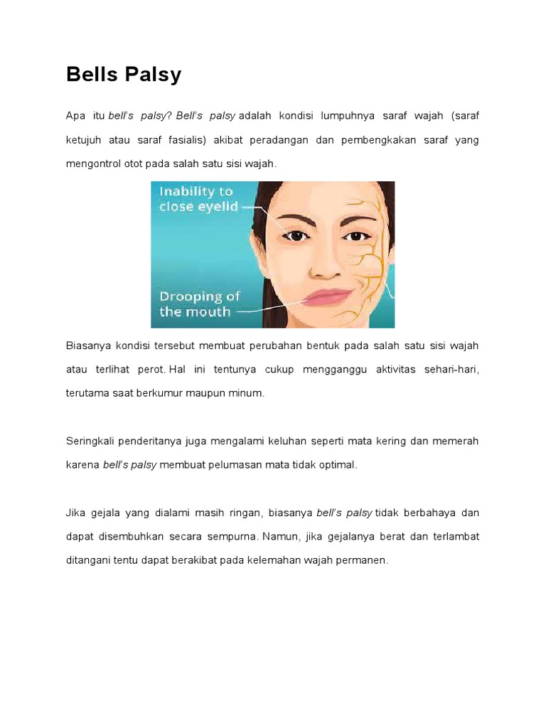 Bells Palsy | PDF