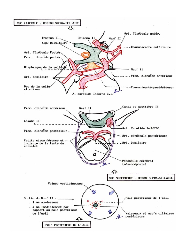 Supra Sellaire | PDF