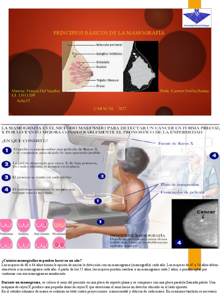 Mamografia de Biofisica | PDF | Mamografía | Radiología