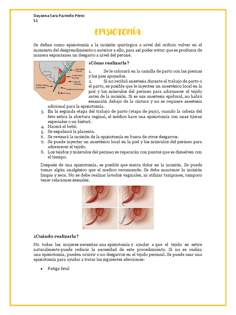 Episiotomía Episiorrafia | PDF | Parto | Especialidades Medicas
