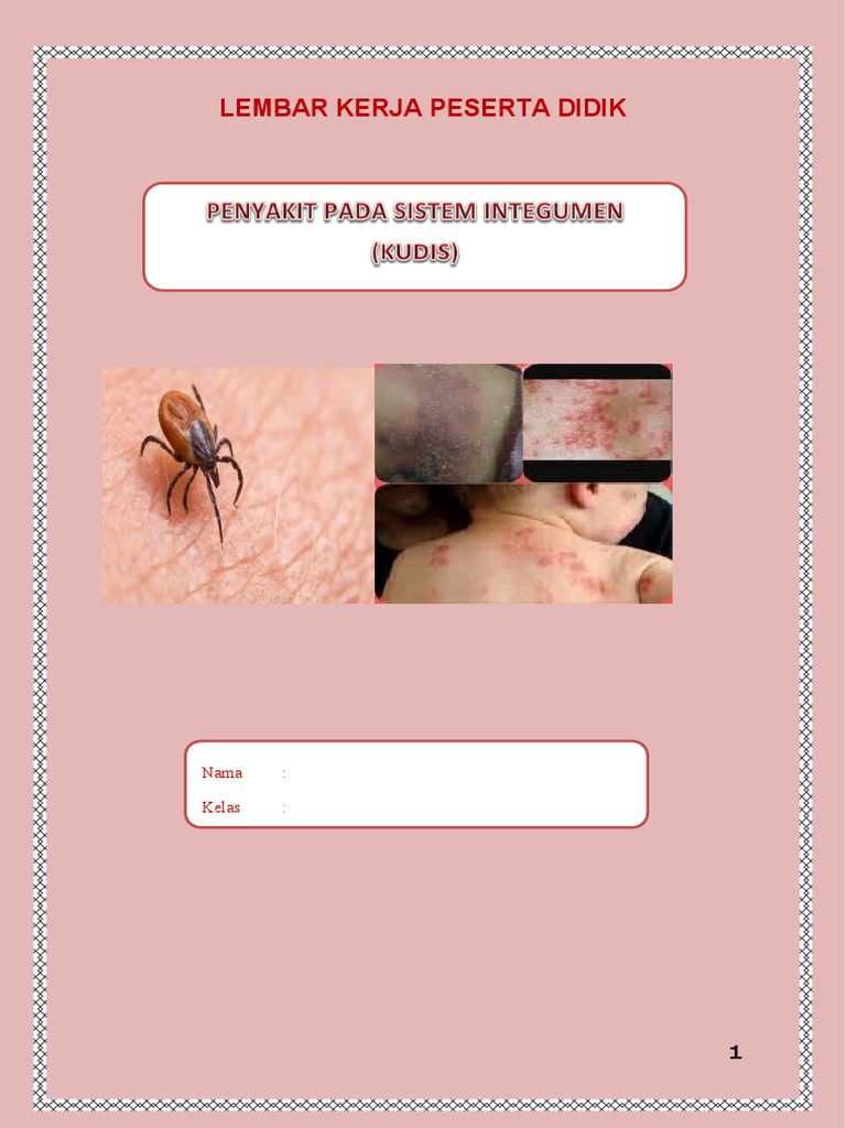 1 LKPD Penyakit Kudis Fitri Indah | PDF