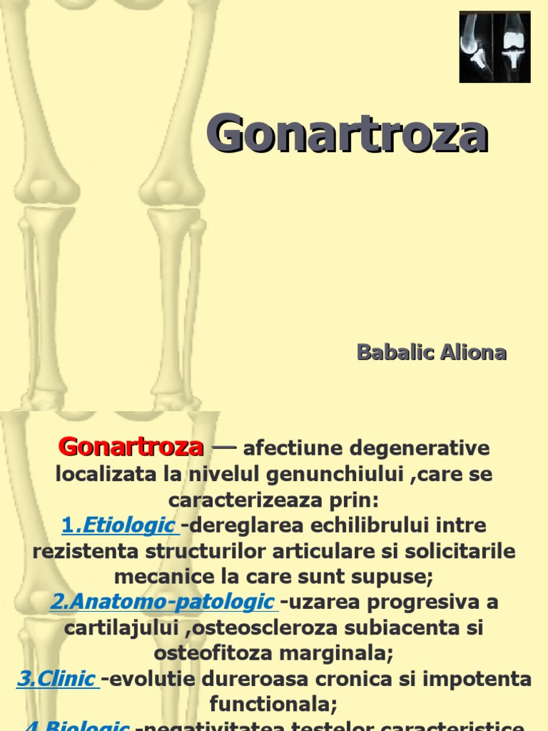 Gon Art Roza | PDF Gon Art Roza | PDF