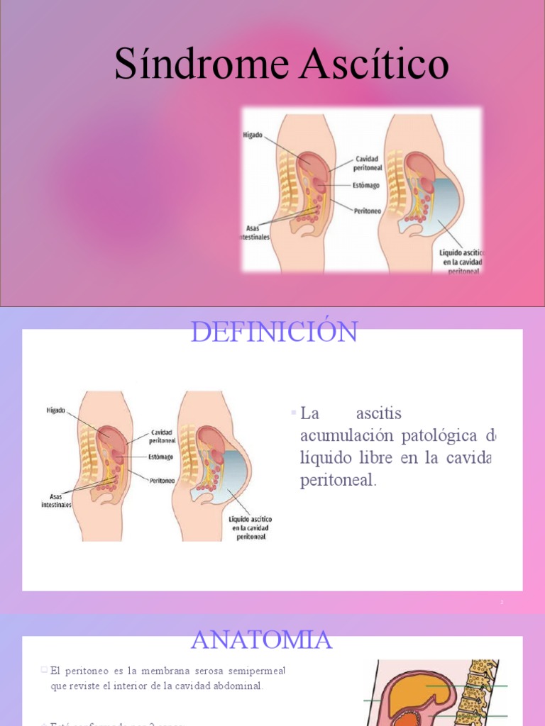 Presentación - Síndrome Ascítico | PDF | Peritoneo | Abdomen