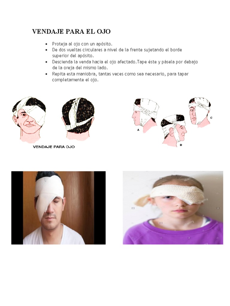 Vendaje para El Ojo y La Nariz | PDF