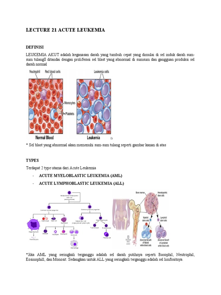 Lecture 21. Acute Leukimia | PDF | Sains & Matematika
