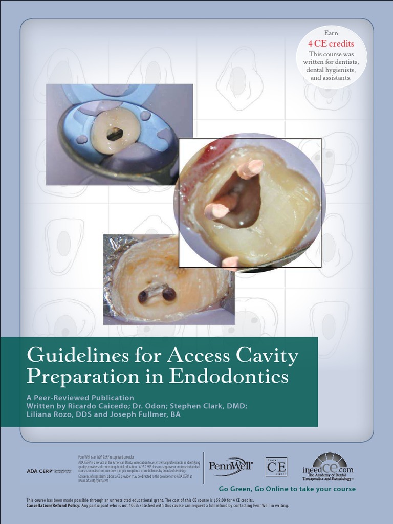 116 Guidelines For Access Cavity | PDF | Dental Anatomy | Dentistry