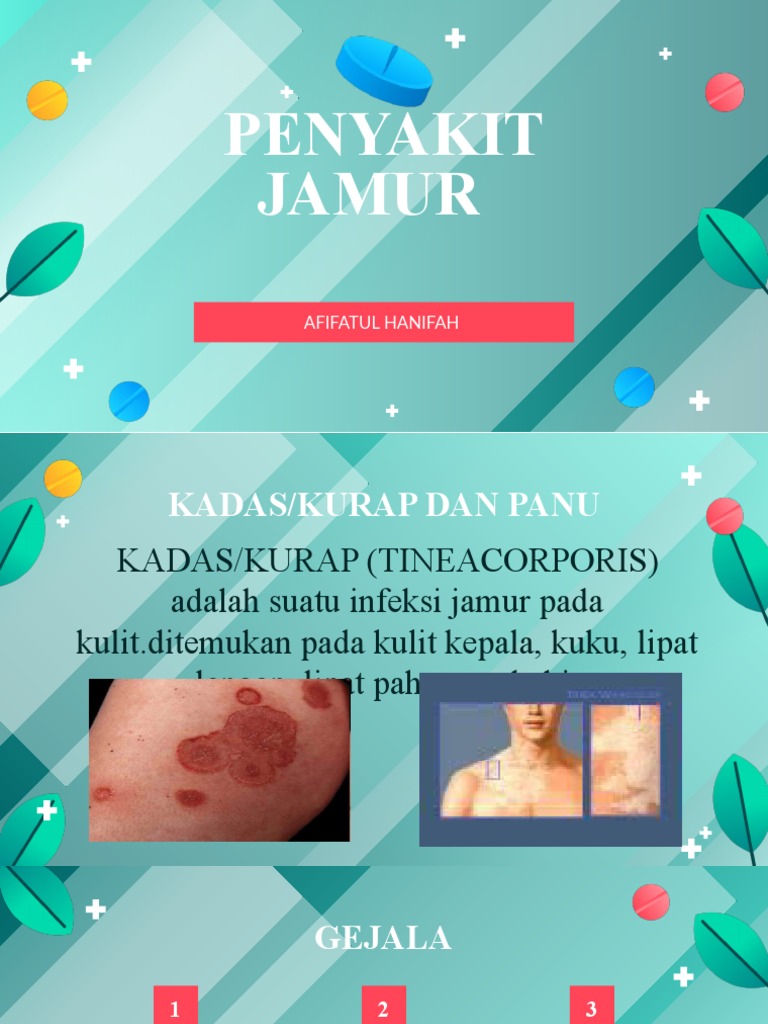 Penanganan Infeksi Jamur Kulit | PDF