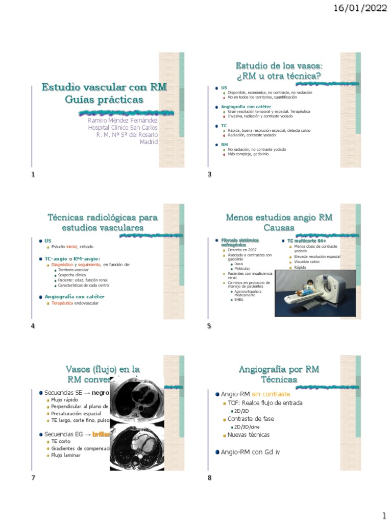 Vascular RM (TSID) Esquema | PDF | Angiografía | Medicina CLINICA
